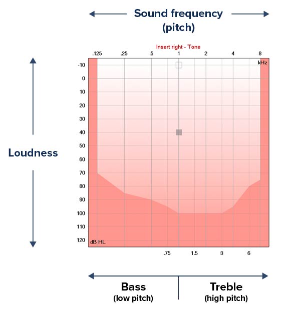 What does an audiogram mean? | What is an audiogram?
